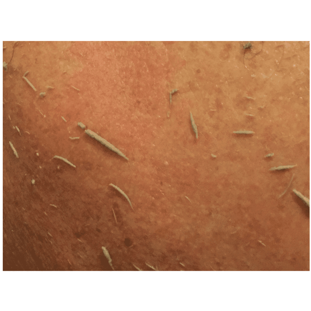 Baiden Mitten Exfoliator System 2024 - Baiden Mitten