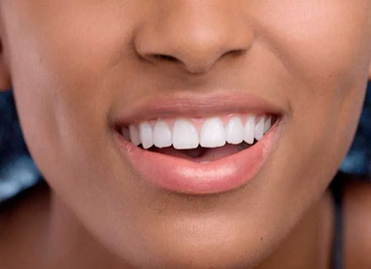 Black Gums and Spots on Gums - Causes, Treatment, and Reasons
